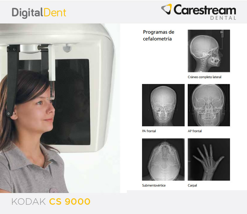 Carestream CS9000:: DigitalDent